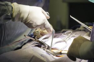 Minimally Invasive Spine Surgery: Less Pain Faster Recovery